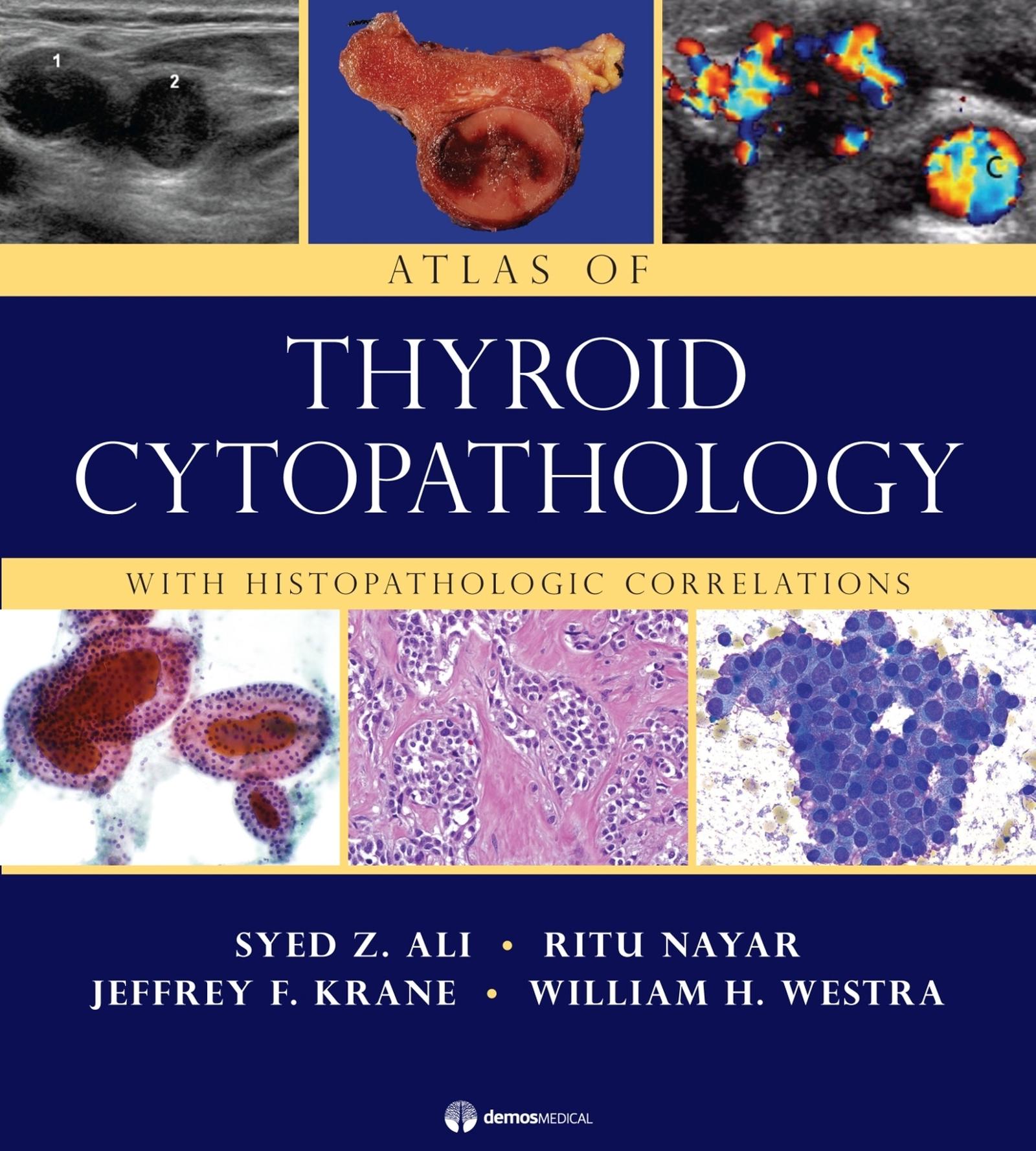 Buy Atlas of Thyroid Cytopathology - MyDeal Australia