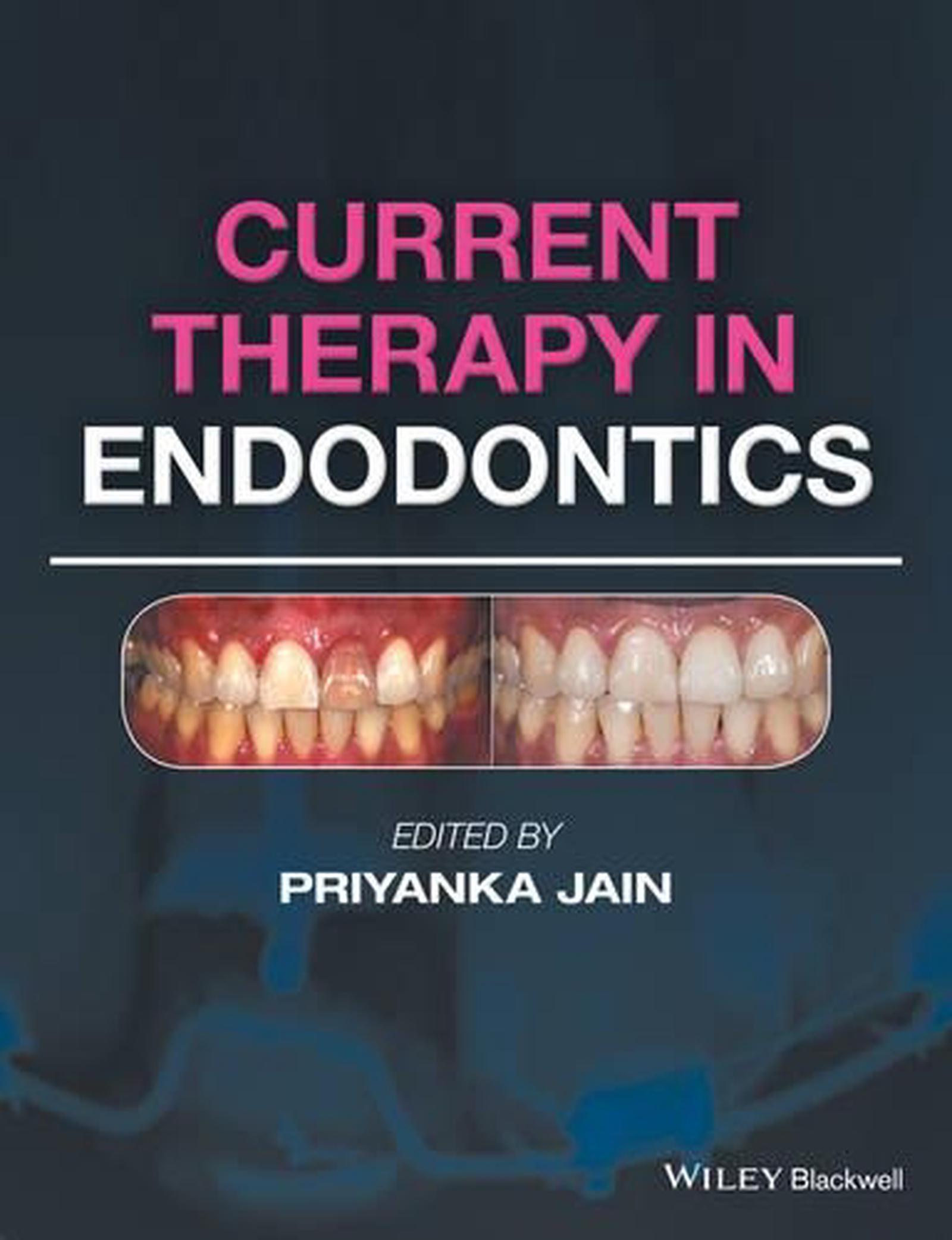 Buy Current Therapy in Endodontics - MyDeal Australia