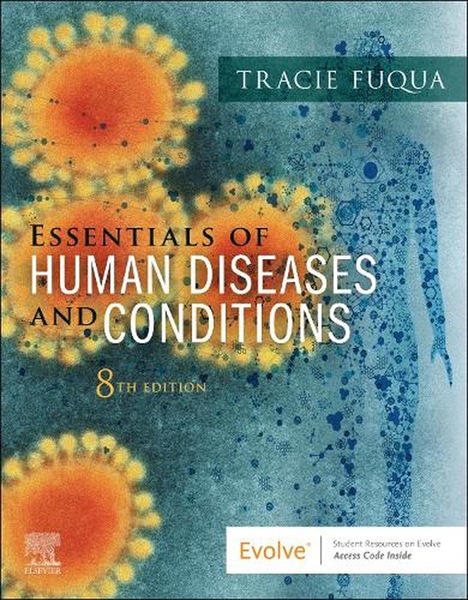 Buy Essentials of Human Diseases and Conditions - MyDeal Australia