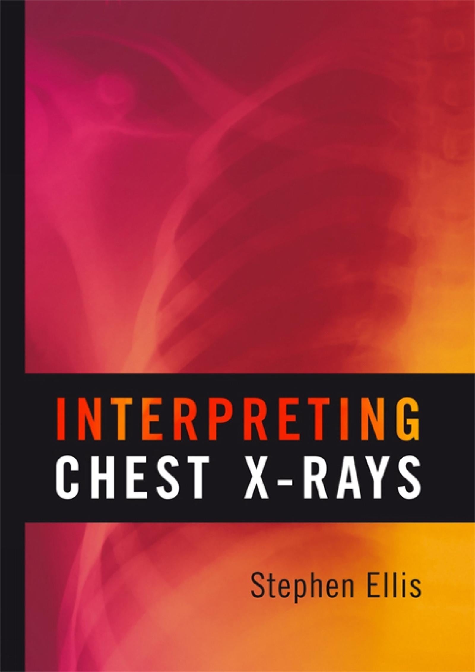 Buy Interpreting Chest X-Rays - MyDeal Australia