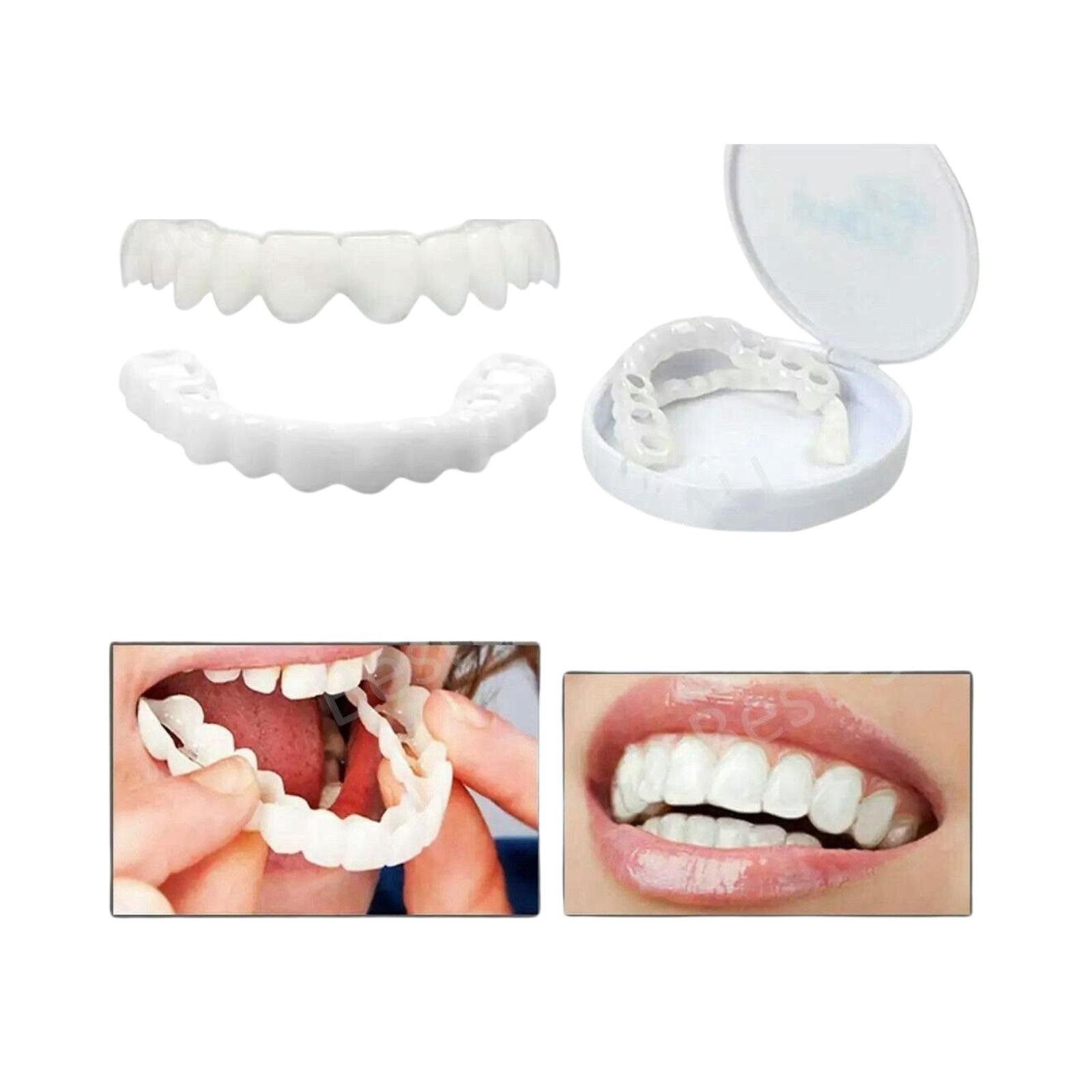 Buy Dental Veneers Dentures Fake Tooth Smile Snap On Bottom Upper Lower ...