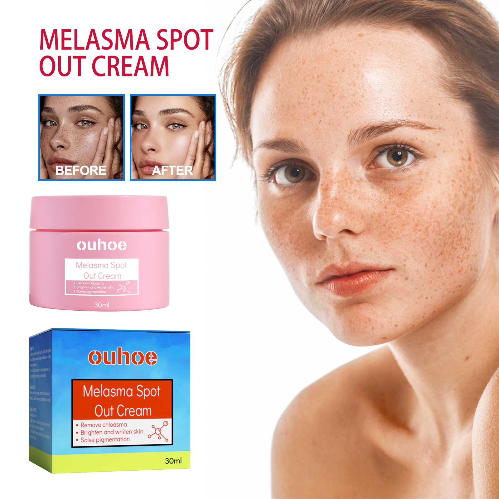 Buy OUHOE Blemish Cream, Whitening Skin Reduce Melanin Melasma Stains ...